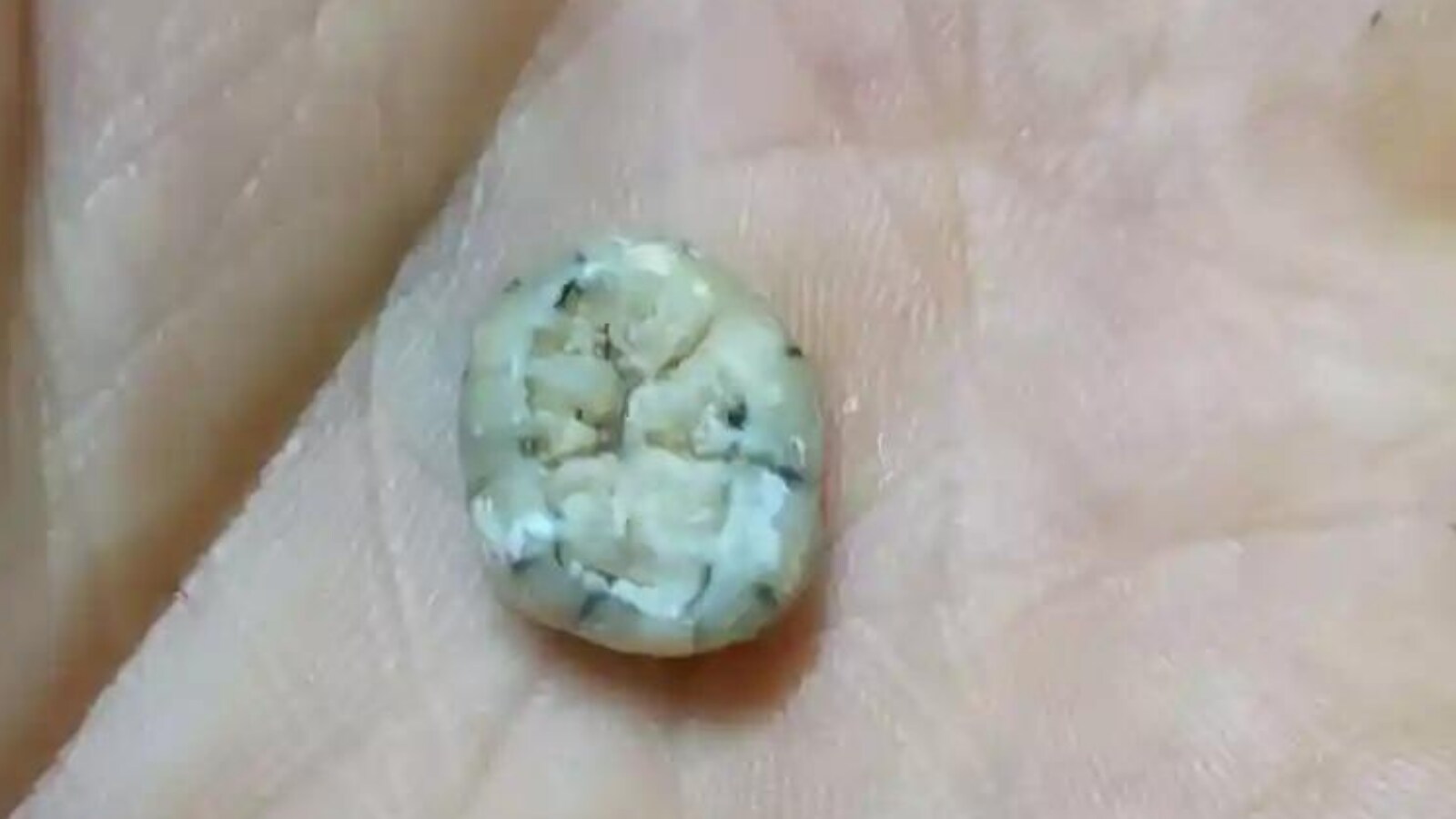 Child's 1,30,000-year-old Tooth Could Uncover the Untold Story of ...