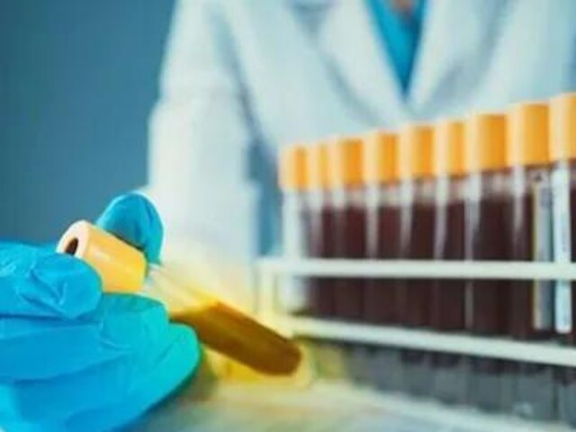 'Golden Blood', The World's Rarest, Found In Only 45 People Globally ...