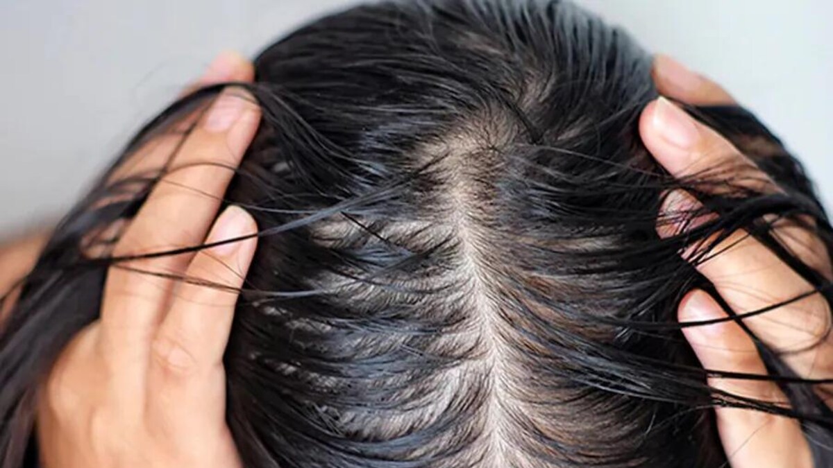 Not Just Skin, Sea Salt Can Make Even Your Hair Better - News18