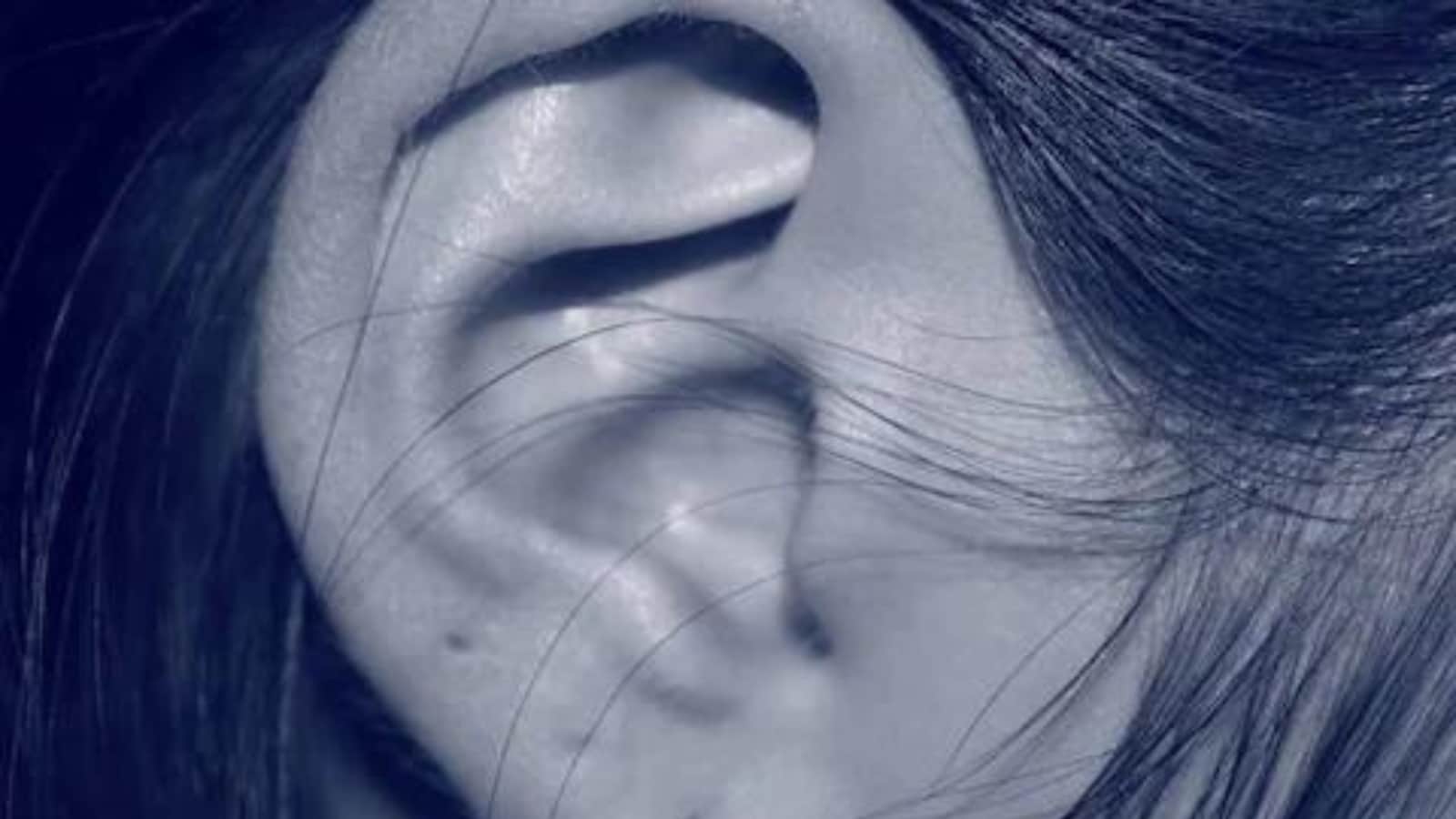 Woman Gets 3D Printed Ear Created From Her Cells, It's Taking Natural ...