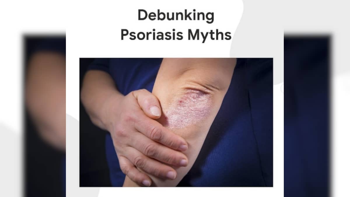 Is Psoriasis Contagious? Ayurveda Expert Debunks Common Myths - News18