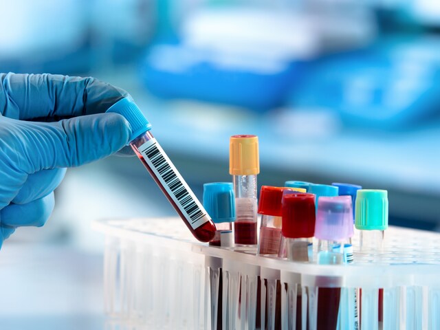 Early Blood Tests Can Predict Death From Traumatic Brain Injury: Study ...