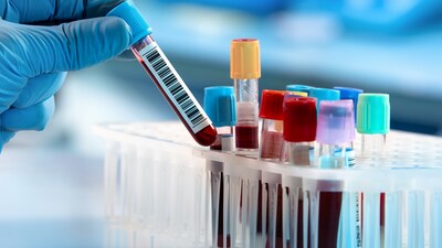 Early Blood Tests Can Predict Death From Traumatic Brain Injury: Study ...