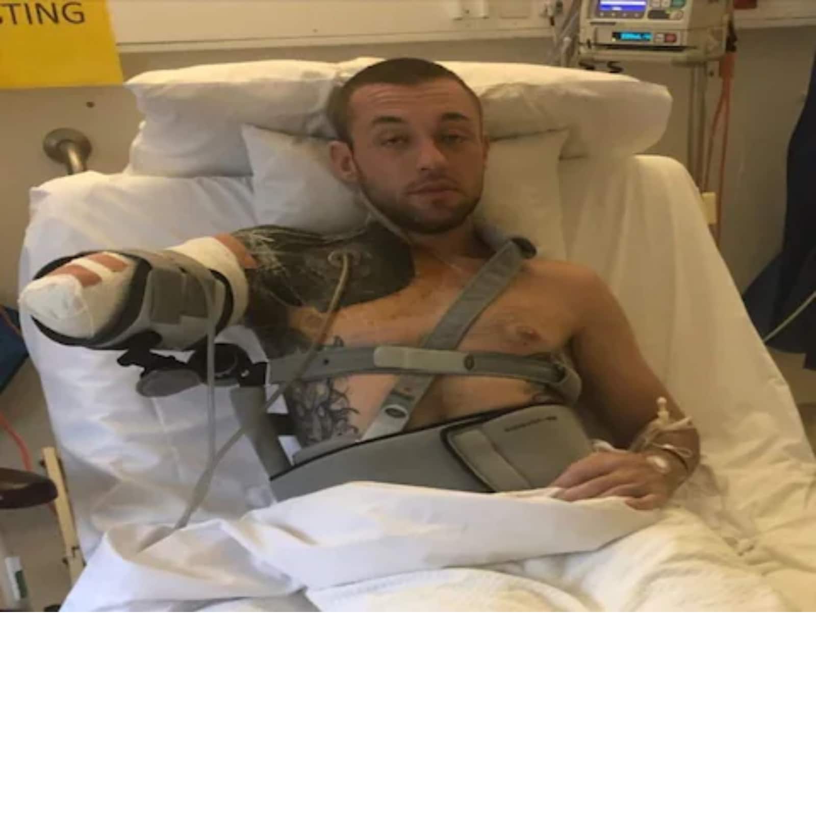 Man Loses Arm After Nasty Gym Accident, Here's What Exactly Happened ...