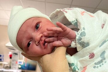 Unusual Human Births