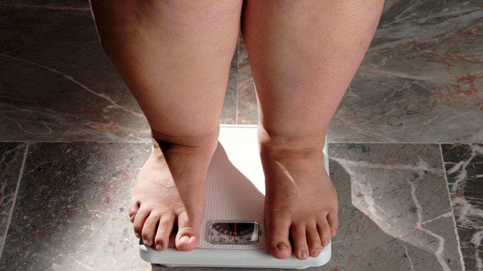 National Family Health Survey Flags Obesity Among Women in South India ...
