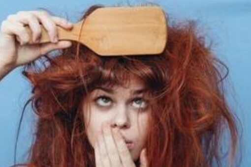Everything You Need To Know About Uncombable Hair Syndrome (UHS) - News18