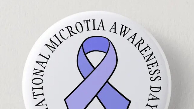 National Microtia Awareness Day 2022: All the Facts You Need on the ...