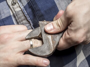 Woman Gets Rings Stuck on Her Finger Removed After 15 Years - News18