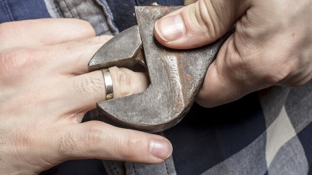 Woman Gets Rings Stuck on Her Finger Removed After 15 Years | Buzz News ...