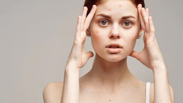 Exposure to Pollution Can Have Serious Effects On Our Skin, Here Are ...