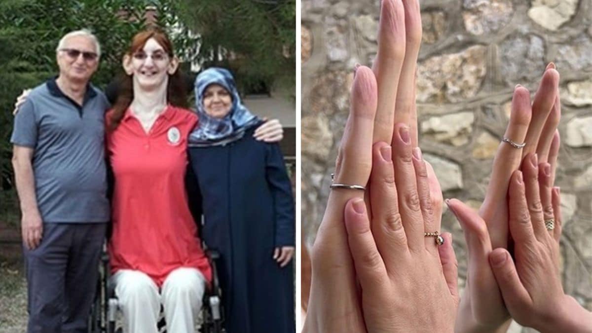 Rumeysa Gelgi, The World's Tallest Woman, Sets Three New Guinness World ...
