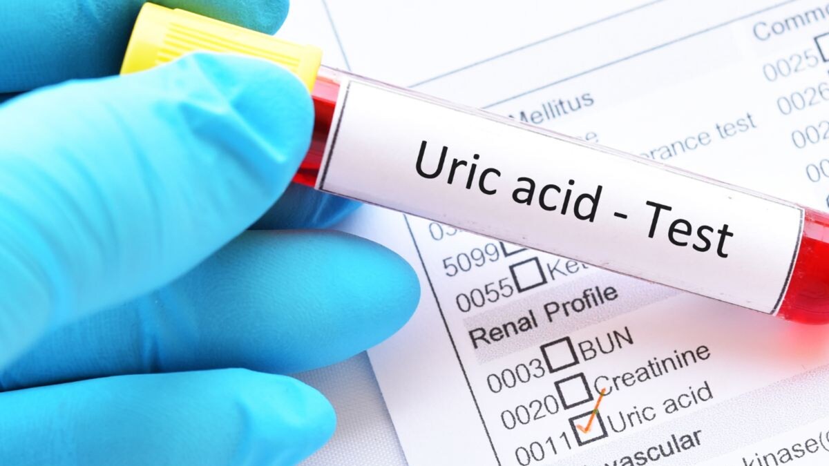 What Are The Causes of High Levels of Uric Acid in The Body? Know From ...