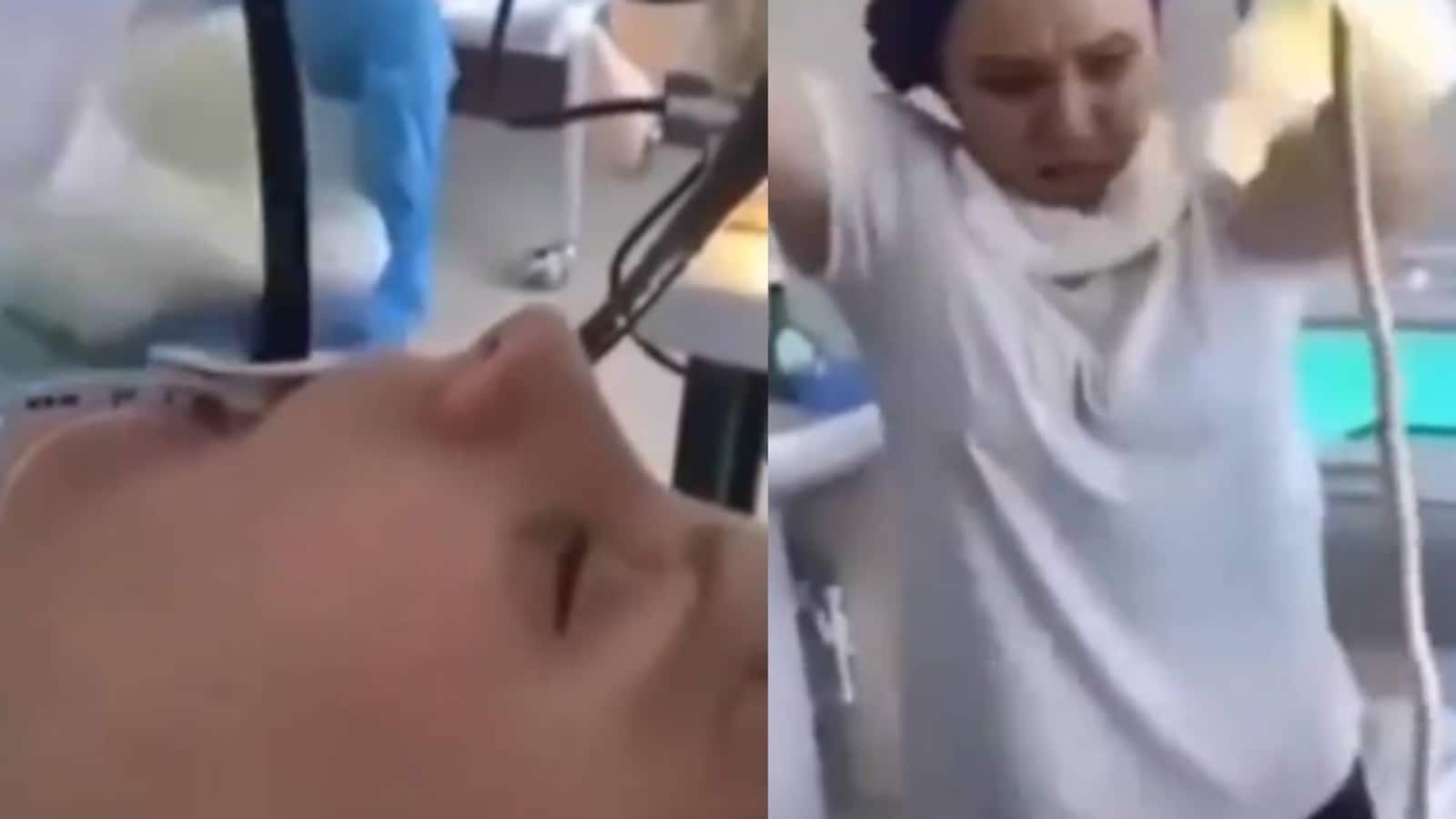 Watch: Medics Pull Out 4-foot Snake From Woman’s Food Pipe; Here's How ...