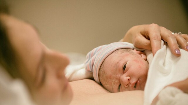 All You Need To Know About Baby Acne, Its Symptoms and Causes ...