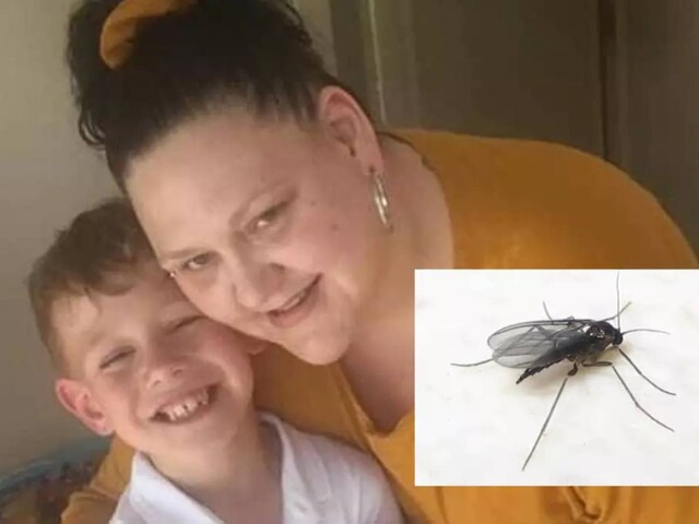 This 40-Year-Old Suffers From Life-Threatening Skin Condition Due To ...