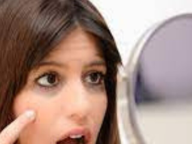 What Are Sunken Eyes? Know About The Causes And Symptoms - News18