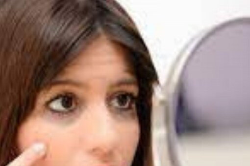 What Are Sunken Eyes? Know About The Causes And Symptoms - News18