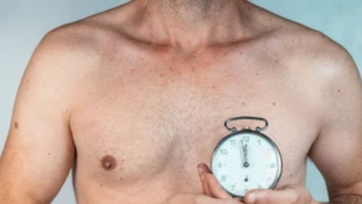 Man Without Heart: Craig Lewis Was World’s First Human To Survive a ...