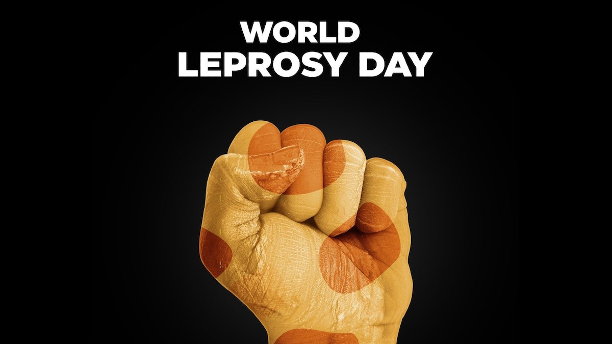 World Leprosy Day 2023: Date, Theme, History and Significance - News18
