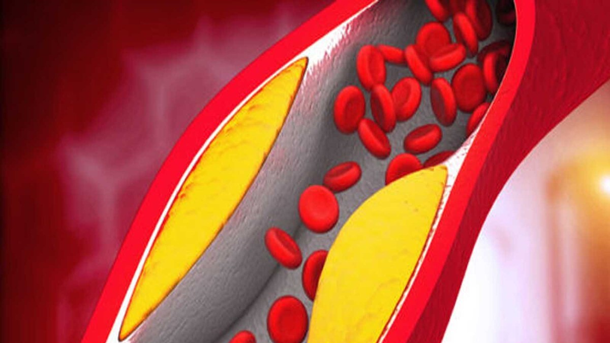 Skin Rashes To Yellow Spots Around Eyes, High Cholesterol Signs Not To ...