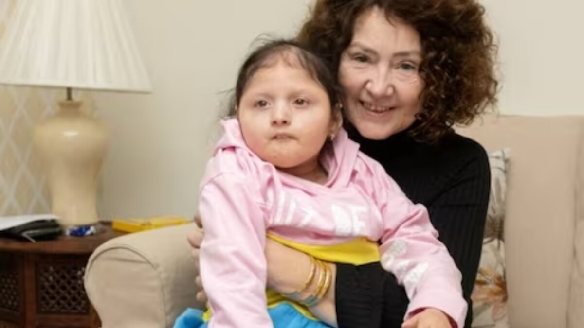 19-Year-Old Girl Suffers From Rare Genetic Disorder, Making Her Look ...