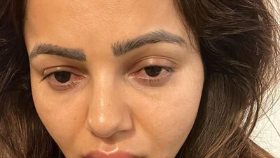 Rubina Dilaik Leaves Fans Worried As She Posts Pics With Swollen Face ...