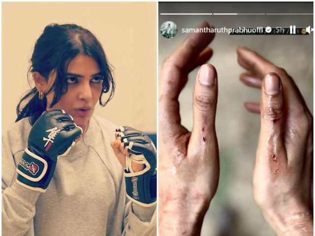 Samantha Ruth Prabhu Injures Herself While Shooting For Indian Version of Citadel - News18