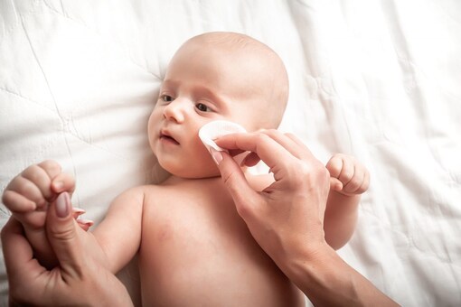 A Doctor’s Guide On Baby’s Skincare - News18