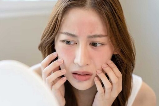 How Your Skin Tone Determines The Effect Of UV Rays On It - News18