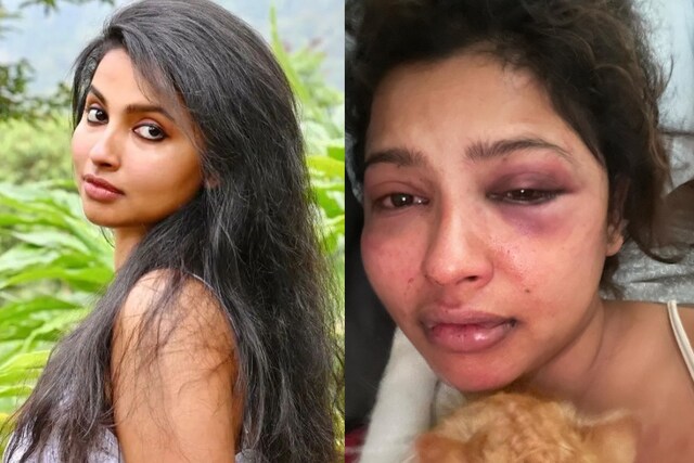 Malayalam Actor Anicka Vikhraman Accuses Ex Anoop Pillai of Assaulting ...