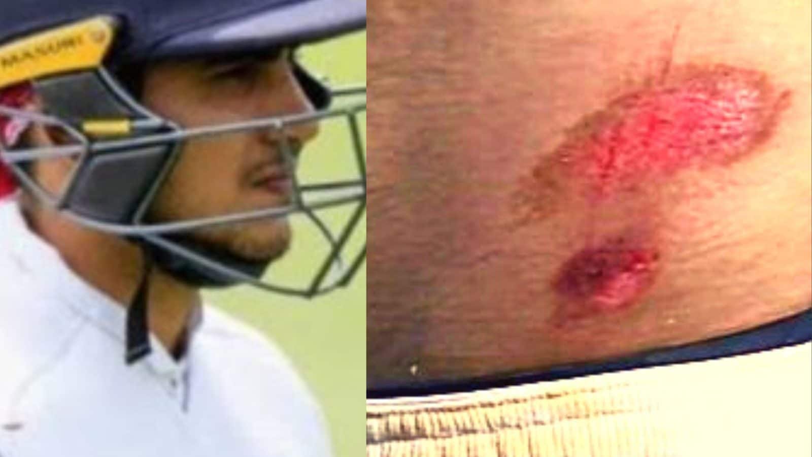 'A Pacer is Bowling, You Gave Him a Breather': Gavaskar Slams Injured ...