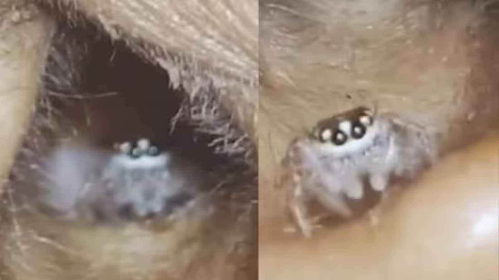 Video Of Spider Crawling Inside Woman's Ear Has Internet Trembling ...