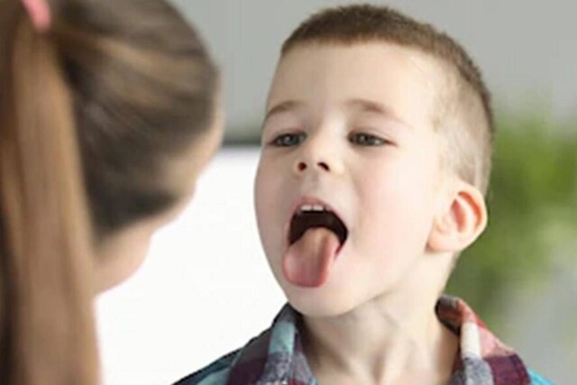 Know Everything About Adenoiditis and How Can It Affect You? - News18