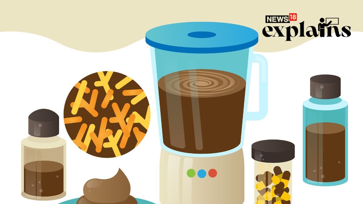 What is a 'Poop Transplant' and How is it Done? EXPLAINED | Explainers ...