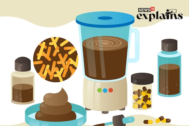 What is a 'Poop Transplant' and How is it Done? EXPLAINED - News18