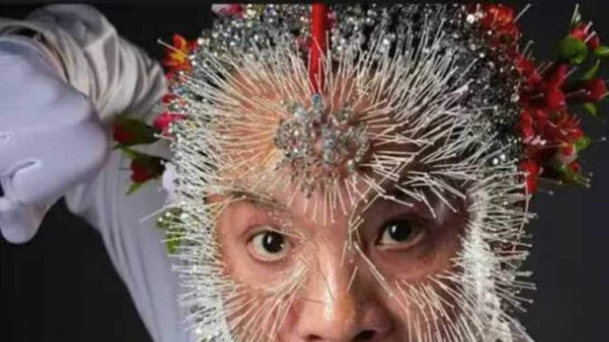 From Pinning Needles To Inserting Rods: 5 Bizarre Guinness World ...