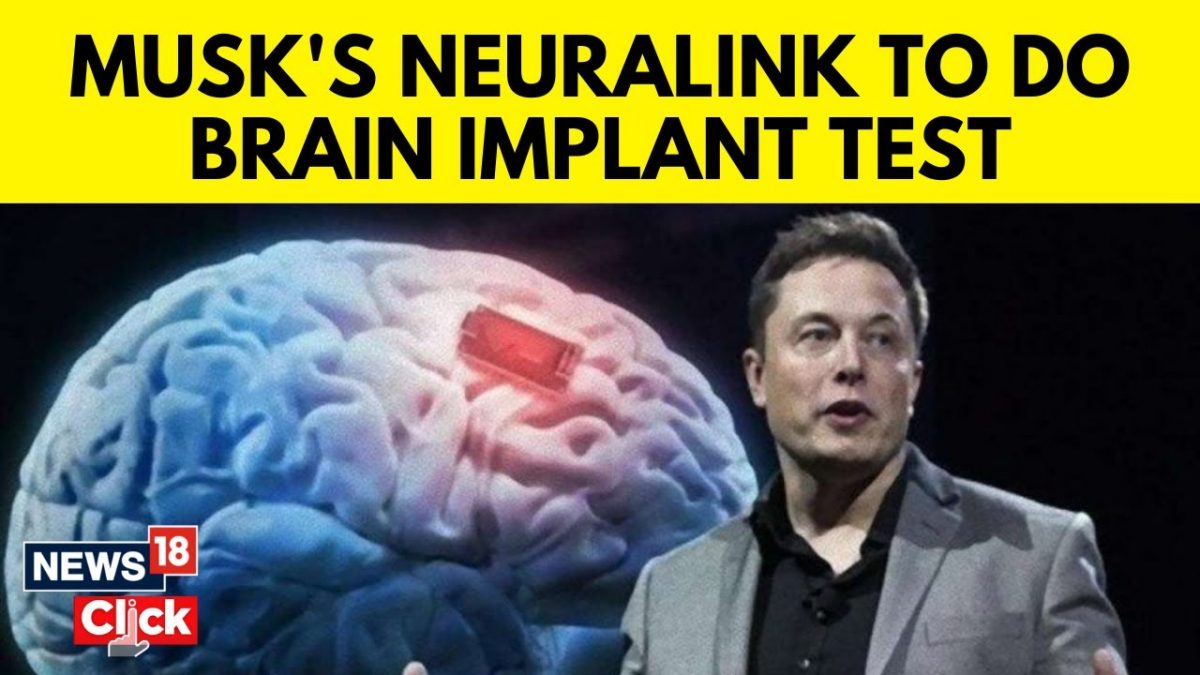 Elon Musk's Neuralink Gets FDA Approval For Study Of Brain | Elon Musk ...