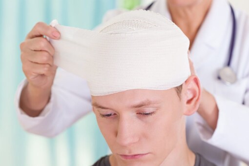 Head Injury; Everything You Need To Know - News18