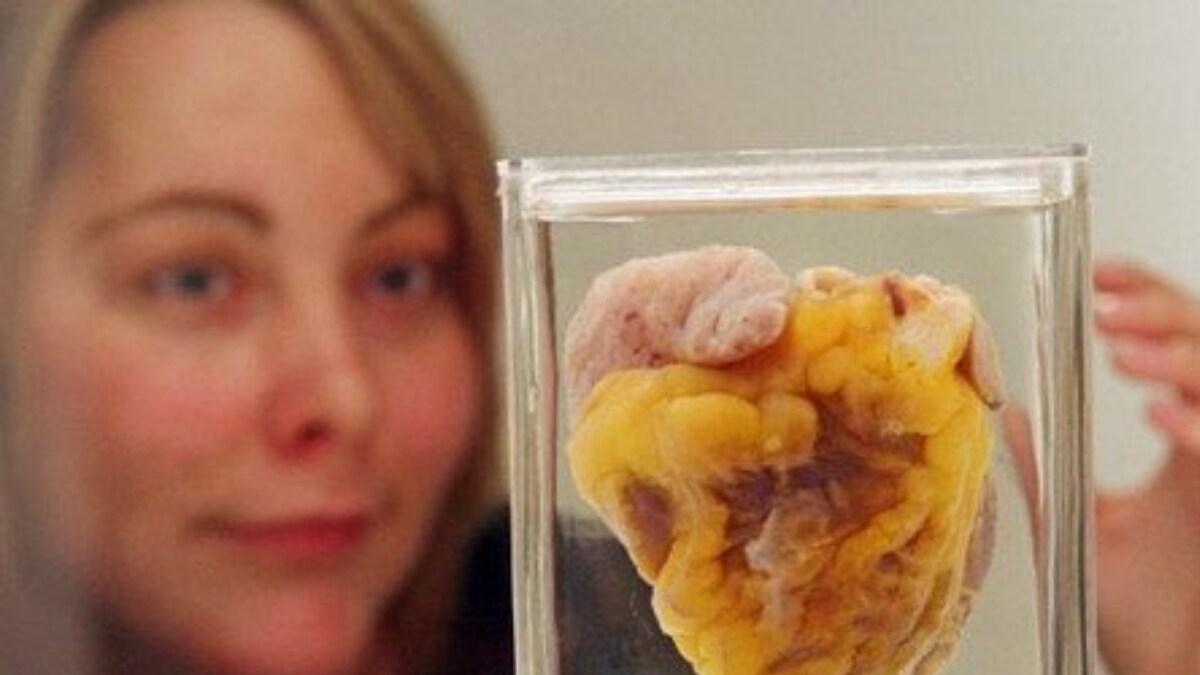 Unbelievable Encounter: Woman Faces Her Own Heart In Museum Exhibit ...