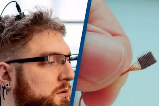 Biotech Company Implants Chips In People's Brains To Tackle Blindness ...