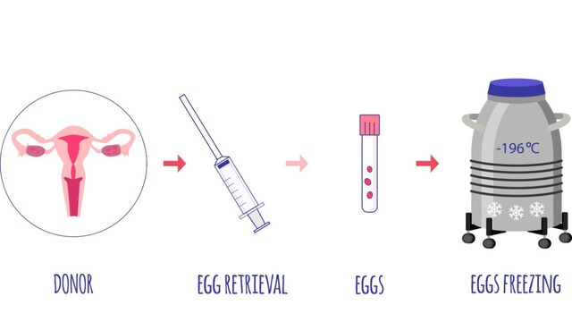 Egg Freezing: The Pros, Cons, and Everything You Need to Know - News18