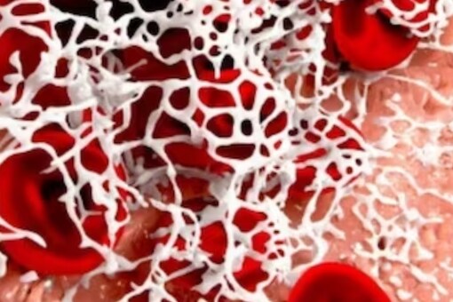 5 Iron And Vitamin C Rich Foods That Boost Platelet Count - News18