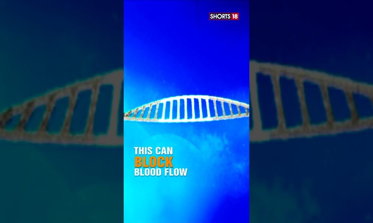 World Sickle Cell Day | What Is Sickle Cell Disease ? | WATCH | What Is ...