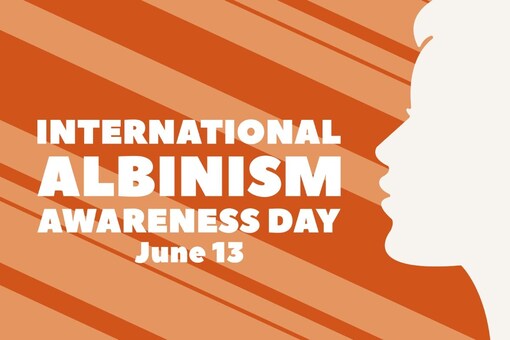International Albinism Awareness Day 2023: Date, Theme, History and ...