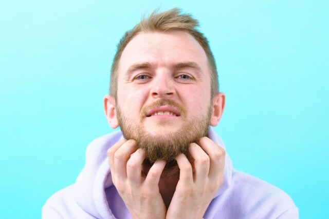 From Flakes to Fab: Tips to Get Rid of Beard Dandruff - News18
