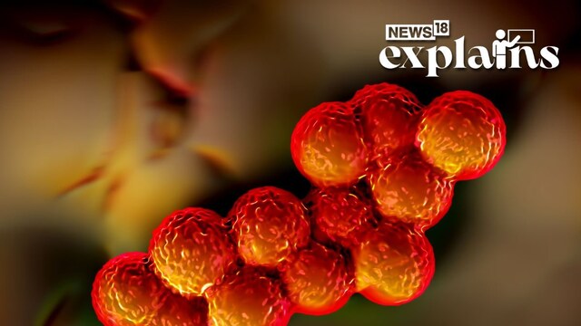 How AI Helped Find a New Antibiotic to Fight a Deadly Superbug | Explained - News18