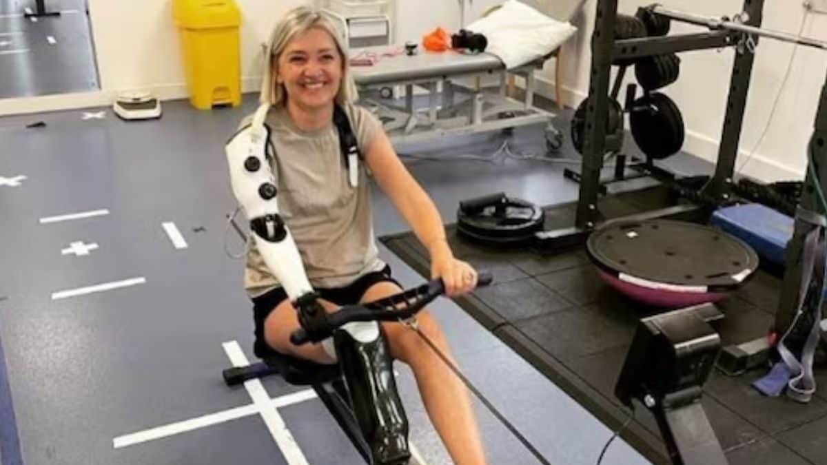 Meet Sarah de Lagarde, The First Person To Have An AI-controlled Bionic ...