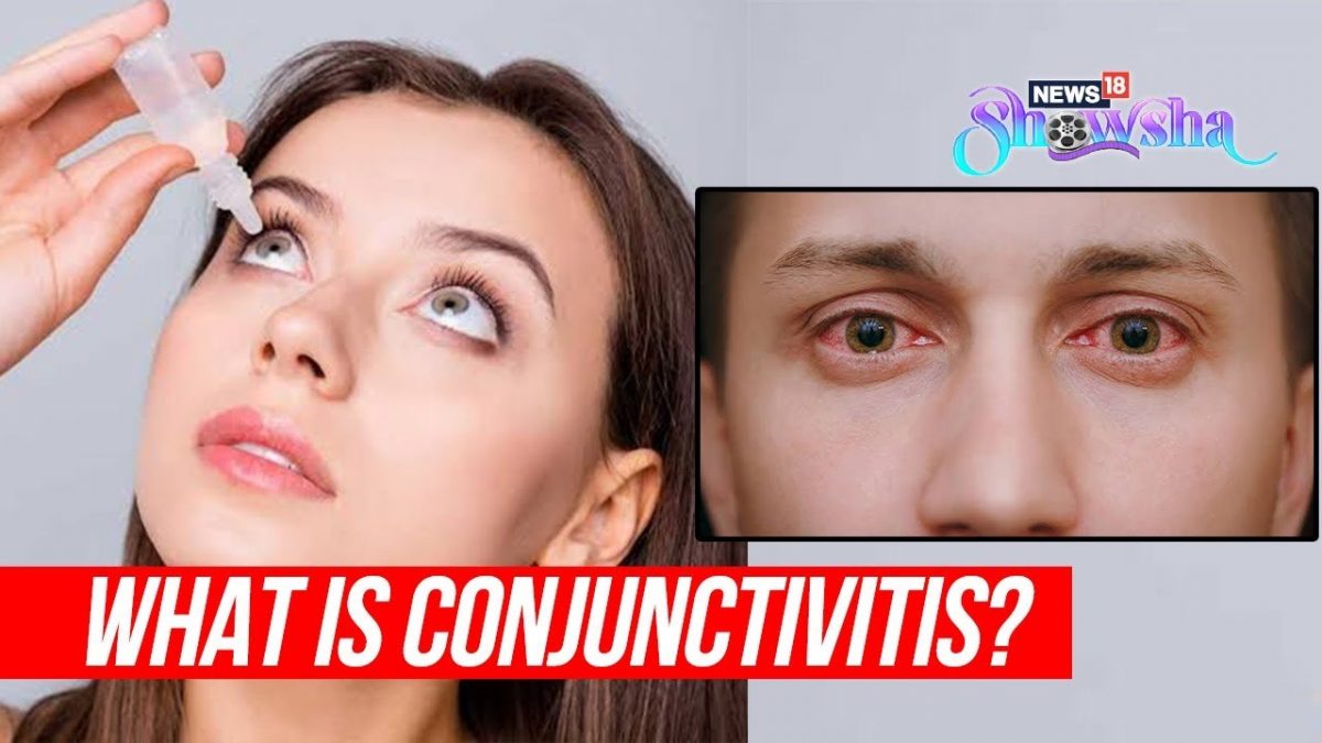 Conjunctivitis Cases On The Rise In Delhi-NCR: What Is Eye Flu? How To ... Conjunctivitis Cases On The Rise In Delhi-NCR: What Is Eye Flu? How To ...