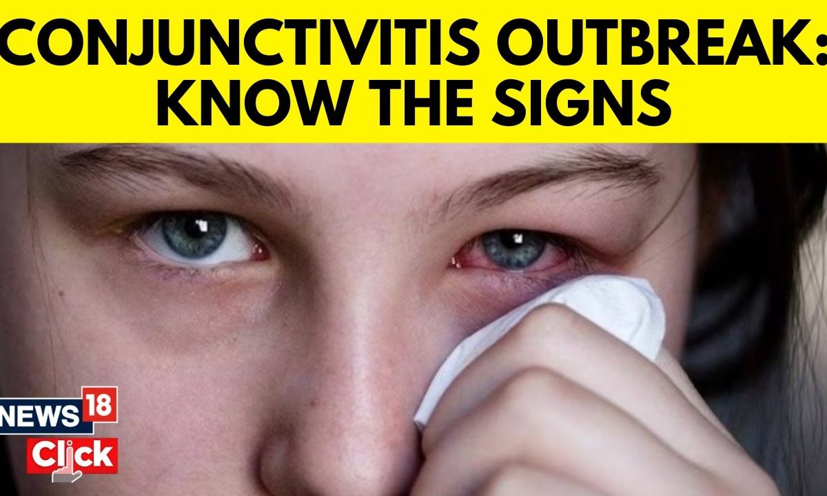Conjunctivitis Outbreak News | Know The Detailed Signs, Symptoms & Treatment | English News - News18